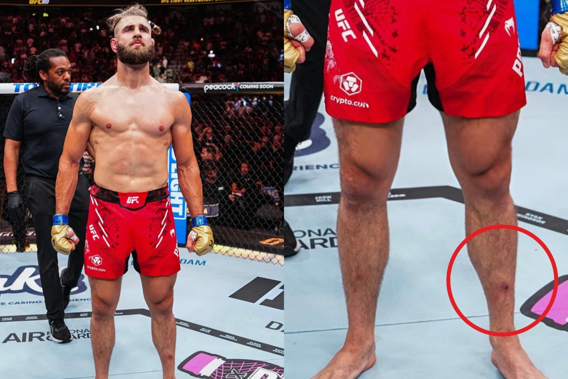 Prochazka confiesa que peleó en UFC 303 con una infección por estafilococos