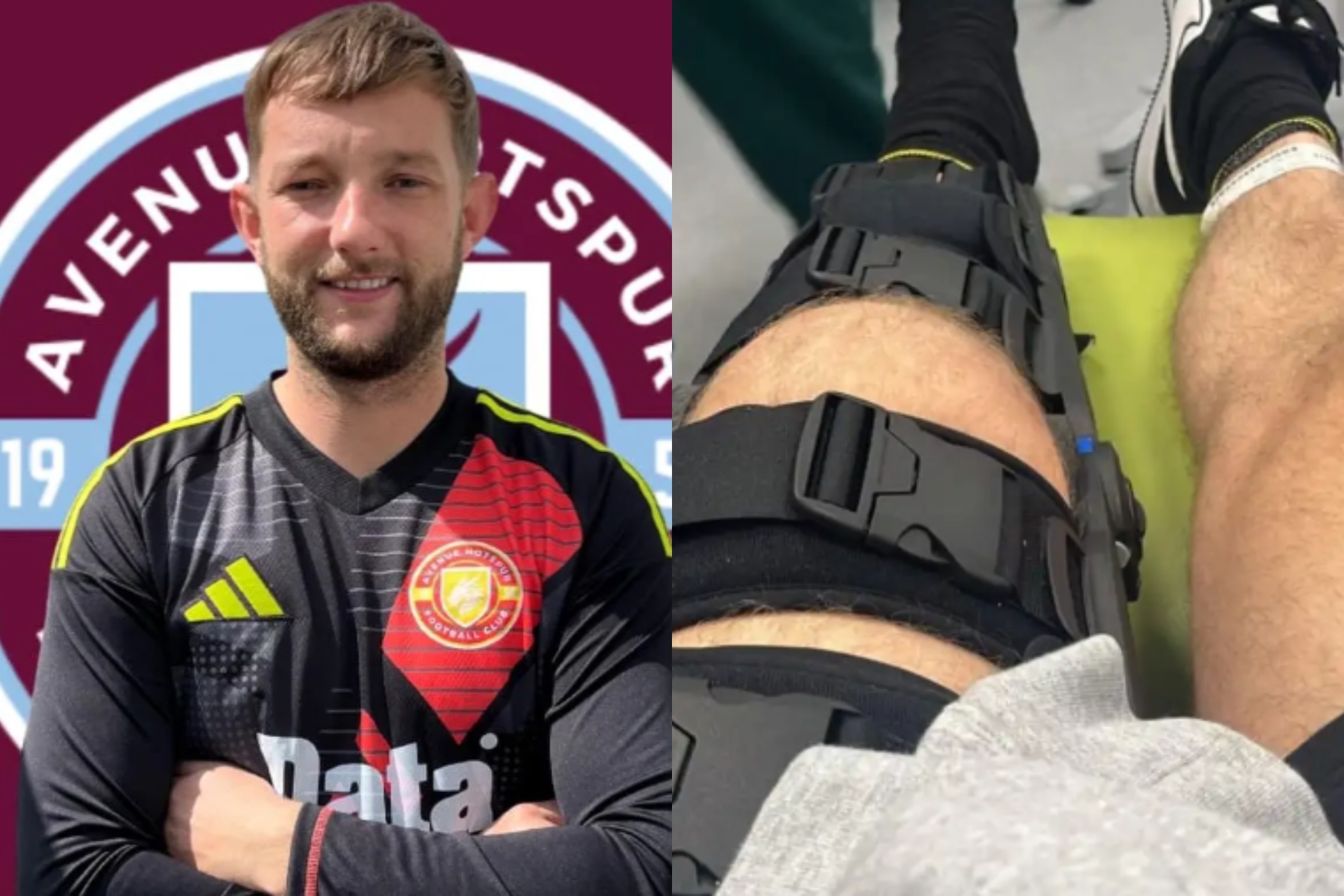 Atacan con bates de béisbol a un equipo de Gales ¡Y al portero le ...