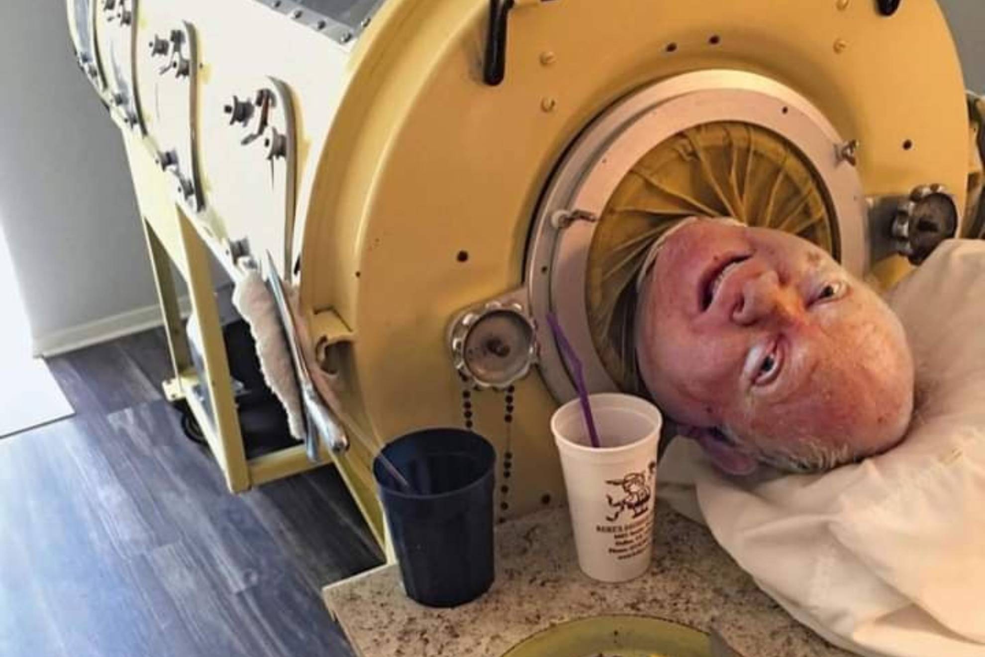 Muere Paul Alexander, el hombre que logró vivir 70 años con un pulmón ...