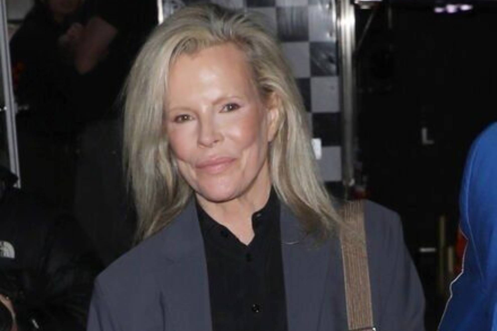Kim Basinger y su sorprendente cambio facial tras su último retoque ...