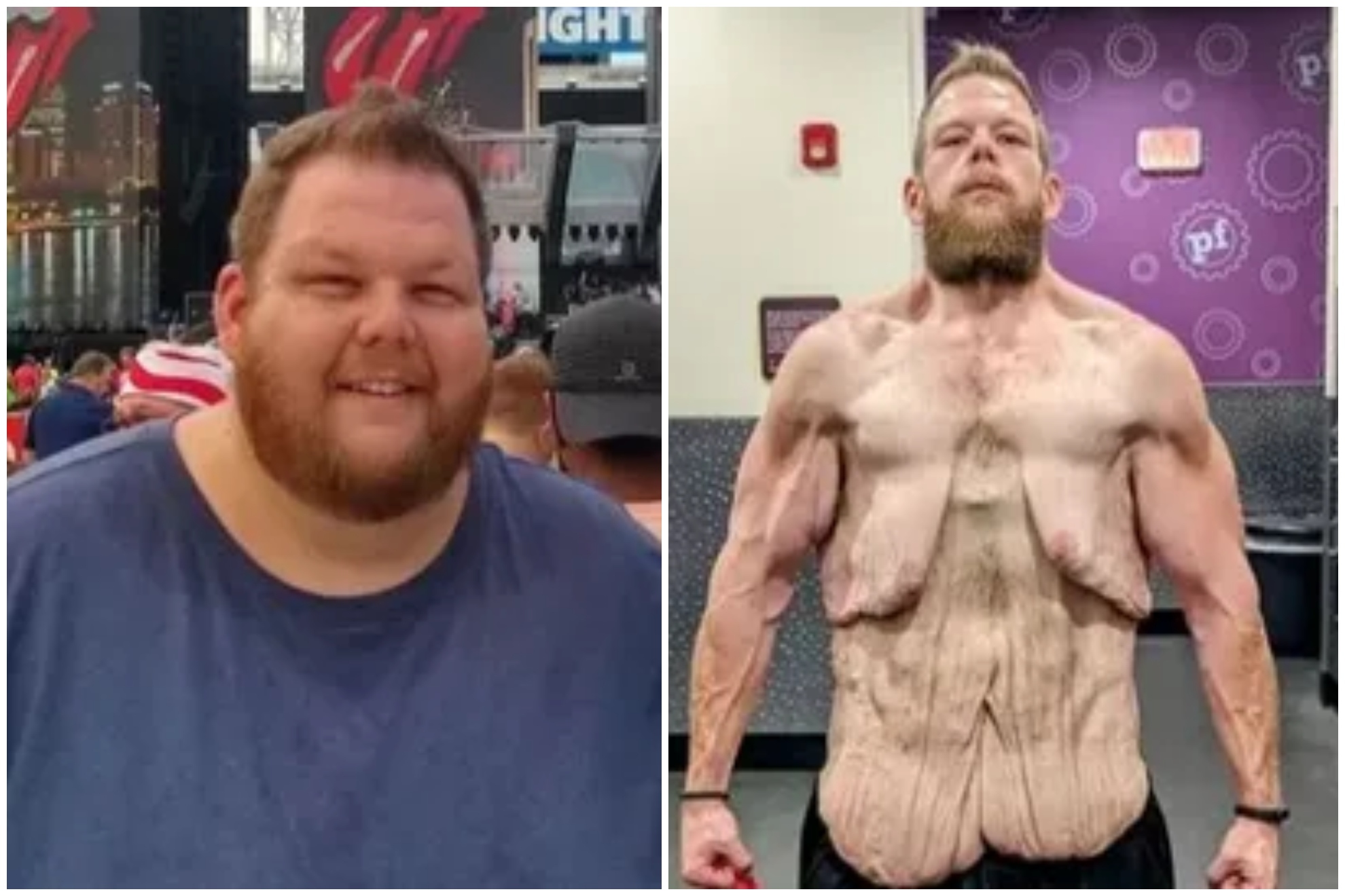 La increíble transformación de un hombre tras perder 160 kilos ...