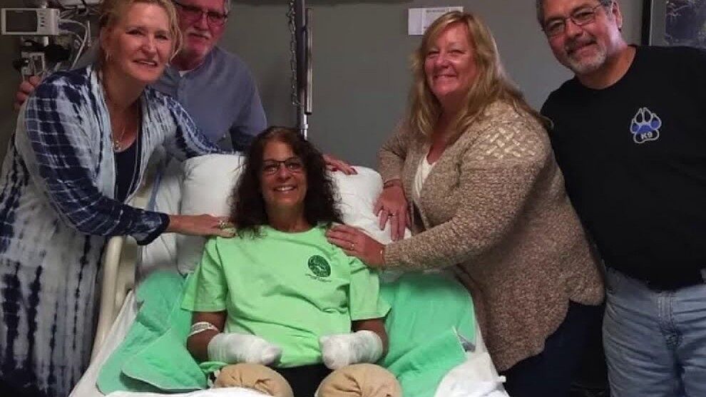 Marie Trainer perdió sus extremidades como consecuencia de la saliva de ...