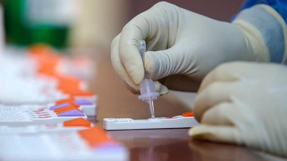 PCR, TMA, test de antígenos y prueba serológica o de anticuerpos ...