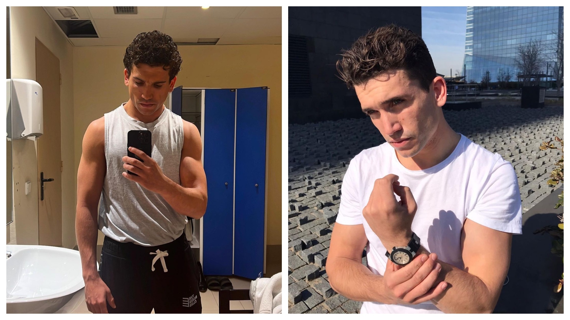 La escalofriante foto de Jaime Lorente tras sufrir una lesión de córnea