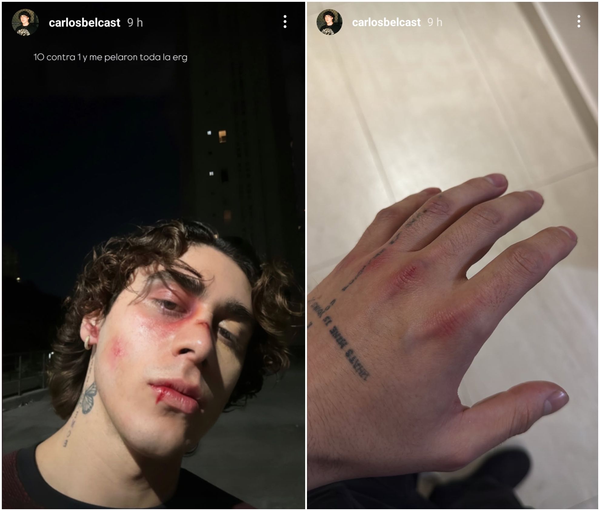 Carlos Belcast recibe una paliza y enciende las alarmas para la Velada del Año 5: "10 contra 1"