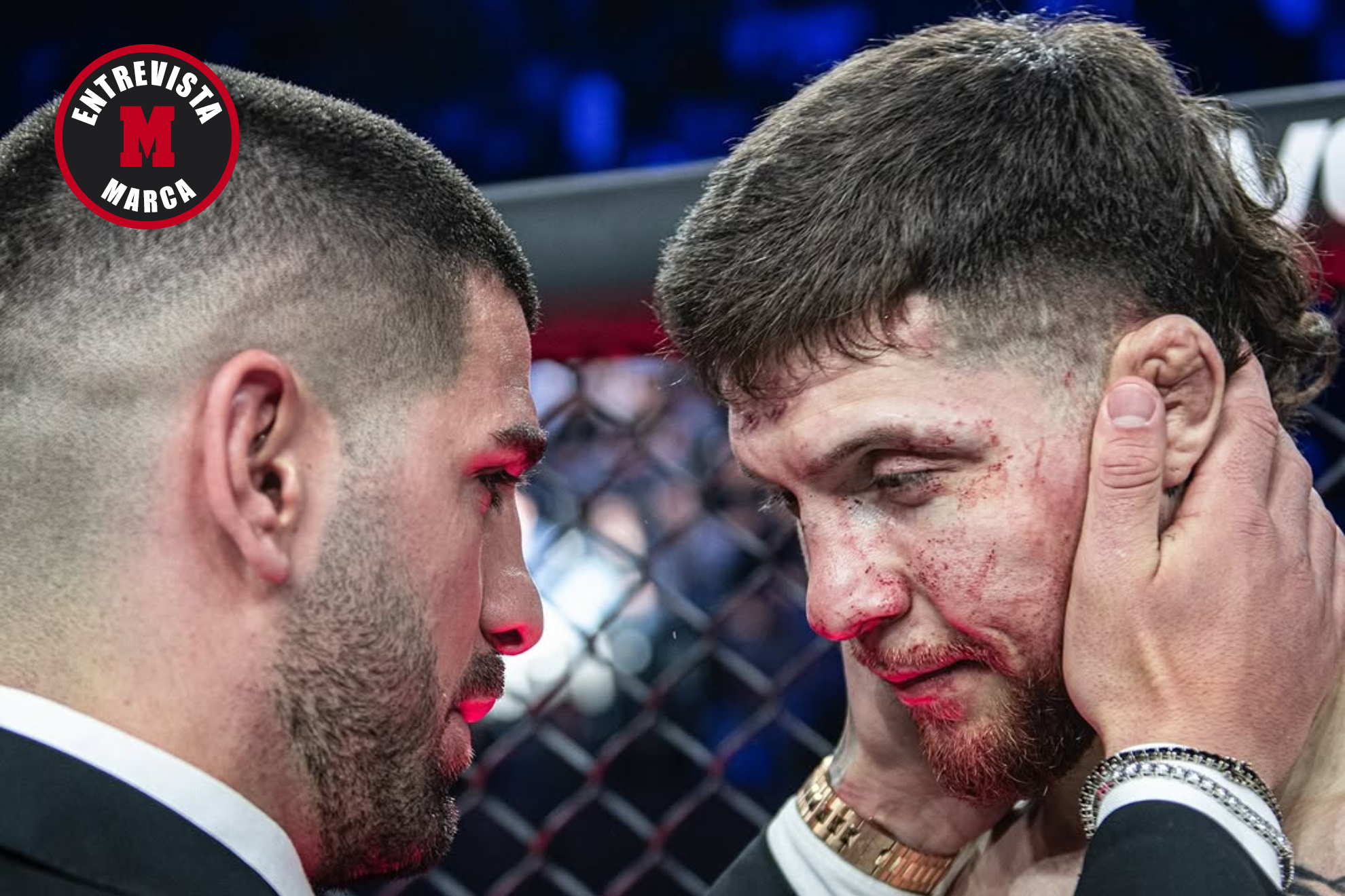 El retorno de 'Colombo' ya está en marcha: "No pensaba que iba a doler ...