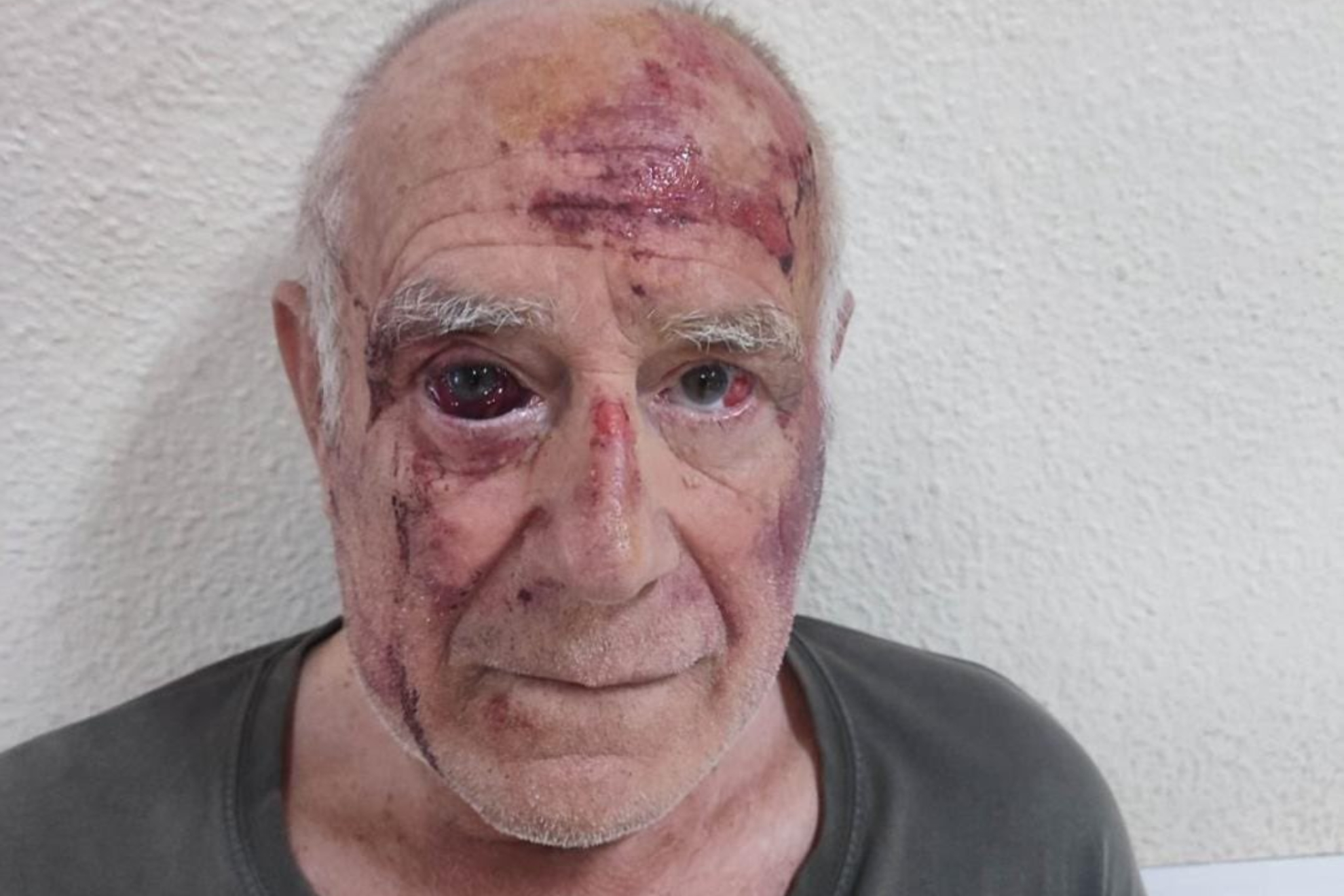 Terrorífica paliza a un anciano de un grupo de jóvenes en Torre Pacheco ...